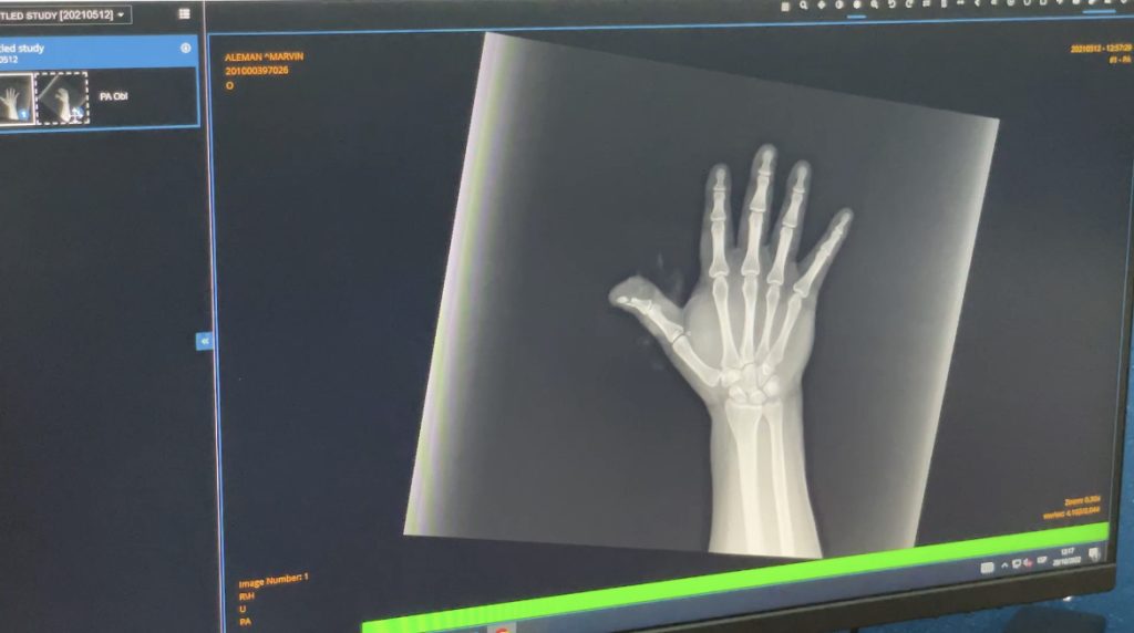 Estrenan equipo digital para rayos X en la Periférica Zona 11 ...